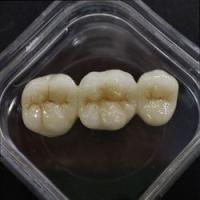 China Ceramic Zirconia Dental Lab Crown Custom Anterior Posterior Teeth Replacement for sale