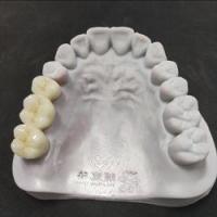 China Dental Impression and Oral Scan Supported China Dental Lab Custom Tailor Zirconia Crowns for sale