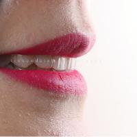 China Ivoclar Emax Laminate Veneers High Translucency China Dental Lab for sale