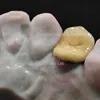China China Dental Artificial Teeth Pfm Dental Metal Ceramic Crown Bridge Customized for sale