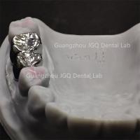China China Dental Lab Dental Full Metal Crown Customized 3D Printing for sale