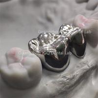 China Fast 3D Printing Dental Full Metal Crown From China Dental Lab for sale