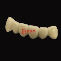 China Customized Pfm Titanium Teeth Durable Corrosion Resistant Ensuring Longevity for sale