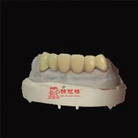 China Customized Pfm Titanium Teeth Durable Corrosion Resistant Ensuring Longevity for sale