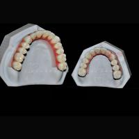 China Dental Implants Restoration Dental Zirconia Screw Crown Implant for sale