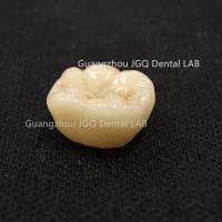 China Customized High-Quality Zirconia Dentures Crafted with Precision for Superior Durability and Aesthetic Appeal From Jgq Dental Lab for sale