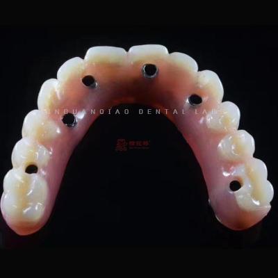 China Snap in Implant Dentures Hybrid Dental Implant Restoration Screwed Retention for Dental Lab for sale