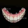 China Implanted Dentures Manufacturer Customized Implant Teeth Bridge with Real Bite Sensation for Oral Restoration for sale
