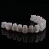 China Dental Implant Screw Retained Crowns Titanium Bar Implant Supported Hybrid Denture for sale