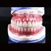 China Implanted Dentures Manufacturer Customized Implant Teeth Bridge with Real Bite Sensation for Oral Restoration for sale