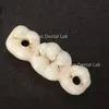 China CE FDA Certified Superior Quality and Performance Dental Implants Zirconia Crowns and Customized Titanium Abutment for sale