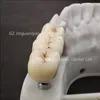China CE FDA Certified Superior Quality and Performance Dental Implants Zirconia Crowns and Customized Titanium Abutment for sale