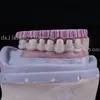China Dental Lab Durability Implants Make Cost-Effective Option in The Long Run for sale