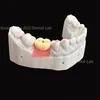 China Dental Lab Durability Implants Make Cost-Effective Option in The Long Run for sale
