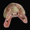 China Choose China Dental Implants for Permanent and Reliable Solution to Missing Teeth with Wholesale Prices for sale