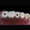 China Customized Implant Teeth Bridge Implanting Guide Look Like Natural Teeth Restore Oral Health, Function and Appearance for sale