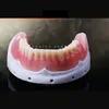 China Ball-Cap Implant Overdenture Offers Excellent Stability and Retention Suitable for Elderly Patients Lab Prices for sale