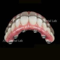 China Full Arch Dental Restoration All on X Zirconia Bridge with Pink Porcelain Titanium Base for sale