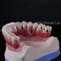 China Full Arch Dental Restoration All on X Zirconia Bridge with Pink Porcelain Titanium Base for sale