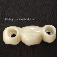 China Dental Implant Supported Dentures Retentive Natural Looking Lab China for sale