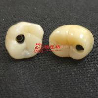 China Customized Dental Crown and Implant with CE FDA Certification Using 3D Laser Printing Technology for sale