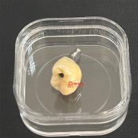 China Customized Dental Crown and Implant with CE FDA Certification Using 3D Laser Printing Technology for sale