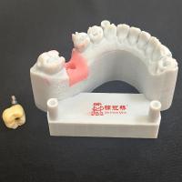 China Customized Dental Crown and Implant with CE FDA Certification Using 3D Laser Printing Technology for sale
