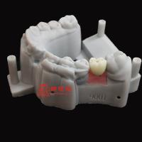 China Custom Zirconia Dentures with Titanium Abutment and Screw Retain Dental Implant Using 3D Laser Printing CE FDA Certified for sale