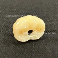 China Custom Zirconia Dentures with Titanium Abutment and Screw Retain Dental Implant Using 3D Laser Printing CE FDA Certified for sale