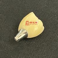China Custom Zirconia Dentures with Titanium Abutment and Screw Retain Dental Implant Using 3D Laser Printing CE FDA Certified for sale