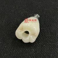 China Custom Zirconia Dentures with Titanium Abutment and Screw Retain Dental Implant Using 3D Laser Printing CE FDA Certified for sale