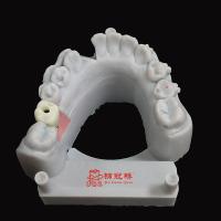 China Customized Screw Retained Dental Implants with Titanium Base and 3D Laser Printing Monolayer Zirconia Dentures for sale