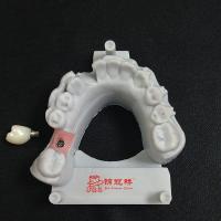 China Customized Screw Retained Dental Implants with Titanium Base and 3D Laser Printing Monolayer Zirconia Dentures for sale