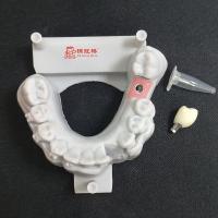 China Customized Screw Retained Dental Implants with Titanium Base and 3D Laser Printing Monolayer Zirconia Dentures for sale