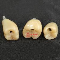 China Dental Implant Supported Dentures Retentive Natural Looking Lab China for sale