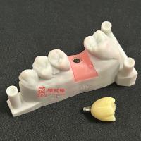 China Dental Implant Supported Dentures Retentive Natural Looking Lab China for sale