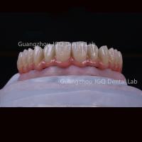 China All On 6 Dental Implants Fixed Dentures Dental Lab All Ceramic FDA CE Certificated for sale