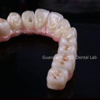 China All On 6 Dental Implants Fixed Dentures Dental Lab All Ceramic FDA CE Certificated for sale