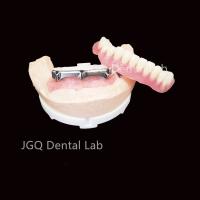 China All on 4 Dental Implant Titanium Bar Dentures Restorations for sale