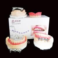 China Full Arch Dental Restoration All on X Zirconia Bridge with Pink Porcelain Titanium Base for sale