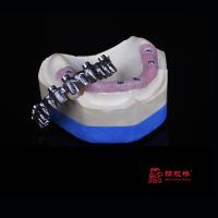 China 3D Printing Titanium Bridge Malone Glazed for Dental Implant Case for sale