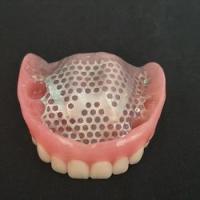 China Snap in Implant Dentures Hybrid Dental Implant Restoration Screwed Retention for Dental Lab for sale