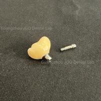 China Customized Titanium Abutment Implanted Dentures for Durable Dental Solutions for sale