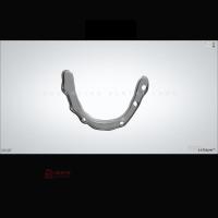 China Customized Titanium Abutment Implanted Dentures for Durable Dental Solutions for sale