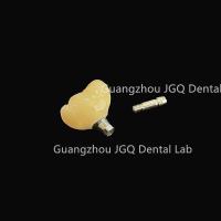 China Customized Titanium Dental Abutment Implant with 3D Laser Printing for sale