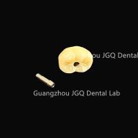 China Customized Titanium Dental Abutment Implant with 3D Laser Printing for sale