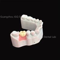 China Customized Titanium Dental Abutment Implant with 3D Laser Printing for sale