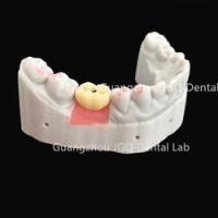 China Customized Titanium Dental Abutment Implant with 3D Laser Printing for sale