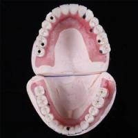 China Dental Zirconia Bridge Over Milled Titanium Bar High Accuracy Customizable for sale