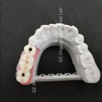 China Dental Zirconia Custom Abutment Lab Precise Esthetical As Strong As Titanium for sale